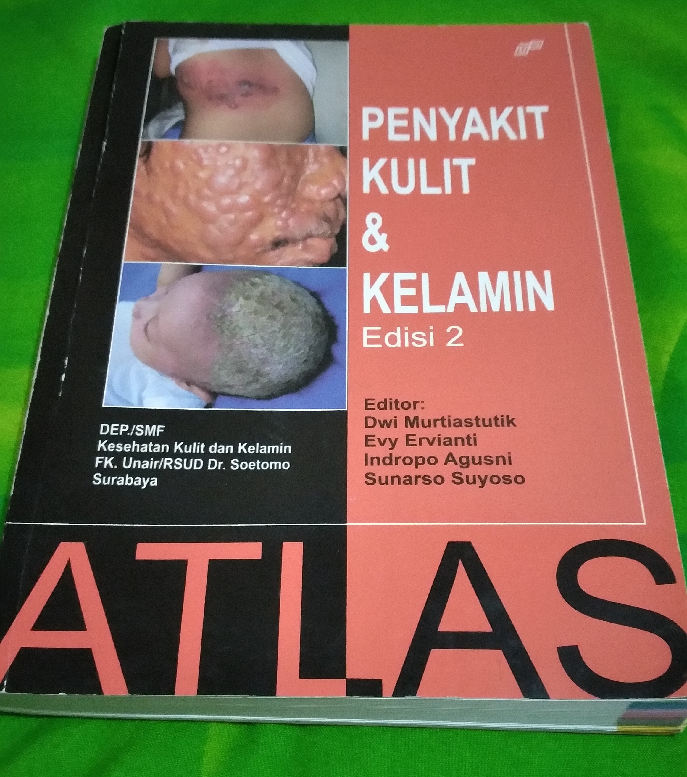 Ujud Kelainan Kulit (UKK)/ Efloresensi – Belajar Sehat